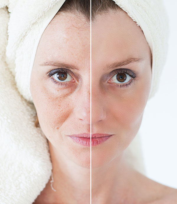 Skin Treatment Experts in Tempe | NEOS Med Spa of Arizona